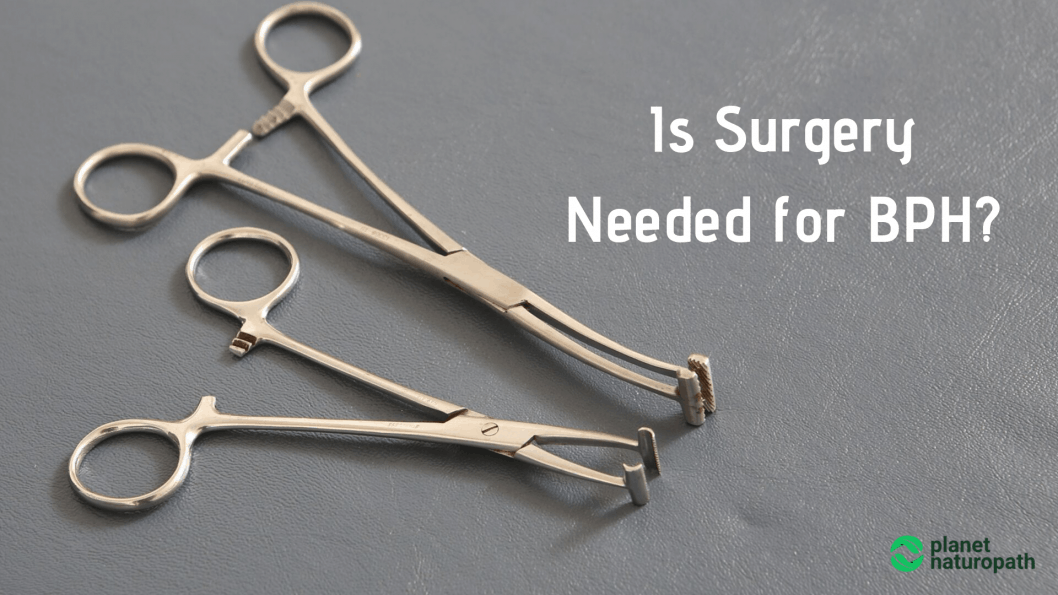 Is Your Prostate Causing You Problems? (natural BPH Treatment) - Planet ...