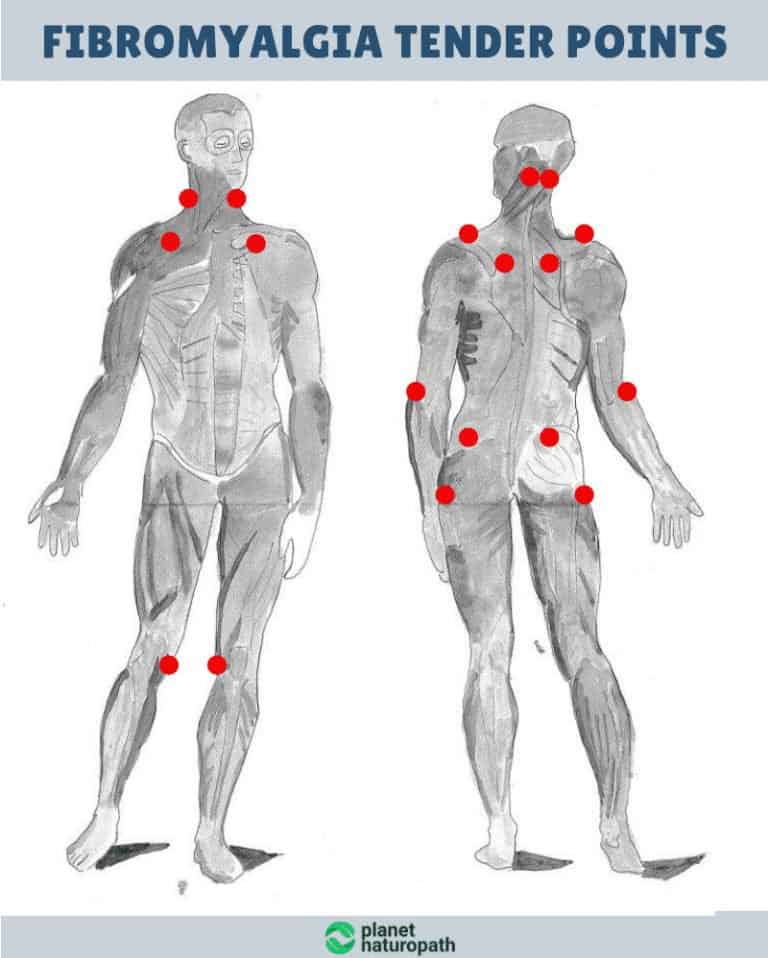 Natural Fibromyalgia Treatment (a Guide To Eliminate Your Pain ...
