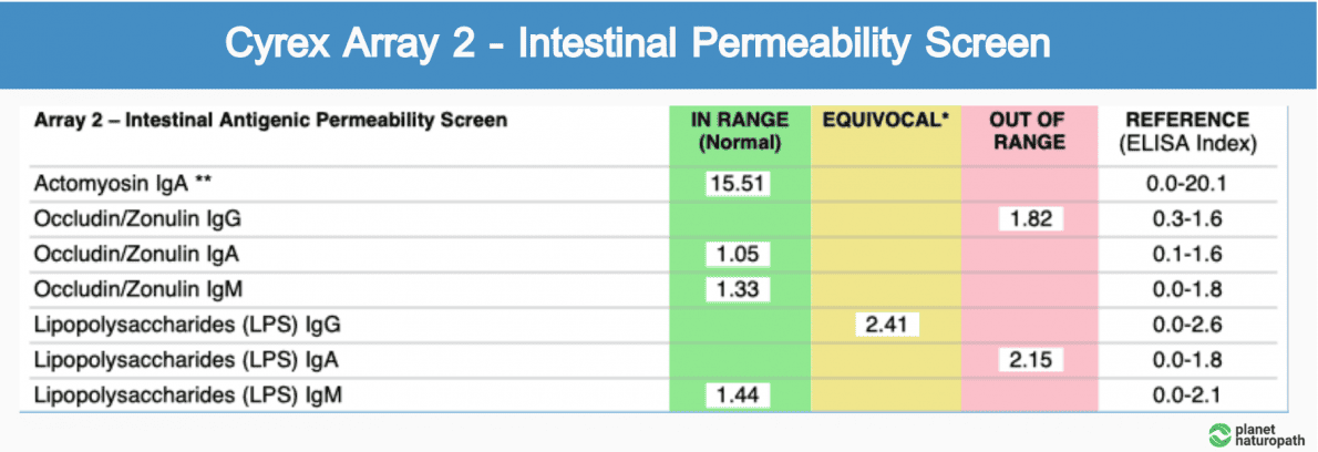 Cyrex Tests: 9 Of The Most Popular Options - Planet Naturopath
