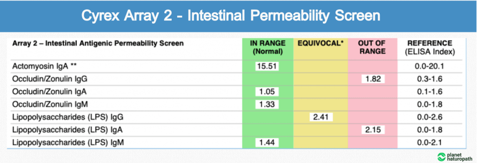 Cyrex Tests: 9 Of The Most Popular Options - Planet Naturopath