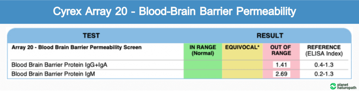Cyrex Tests: 9 Of The Most Popular Options - Planet Naturopath
