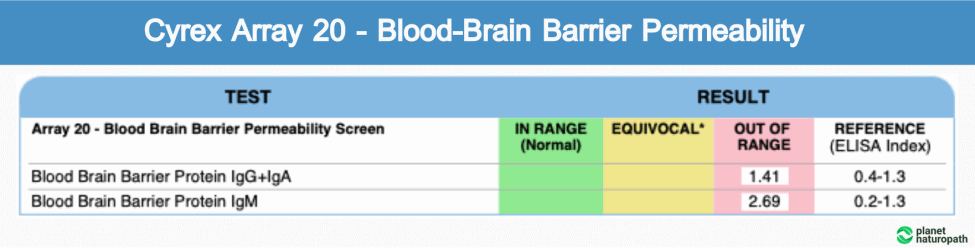 Cyrex Tests: 9 Of The Most Popular Options - Planet Naturopath