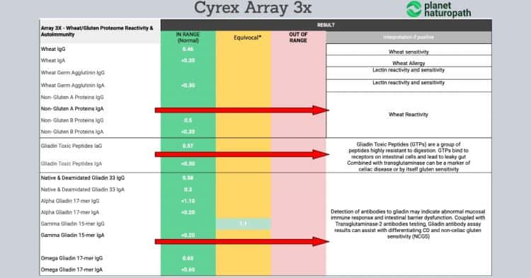 Cyrex Array 3X Test (identify Celiac Or Gluten Sensitivity)