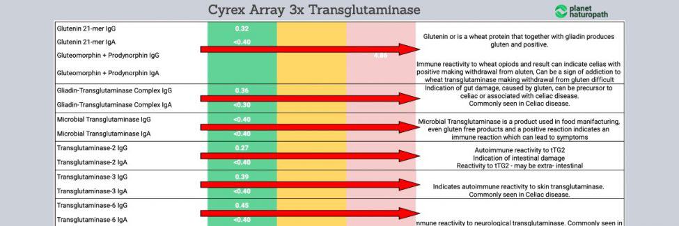 Cyrex Array 3X Test (identify Celiac Or Gluten Sensitivity)