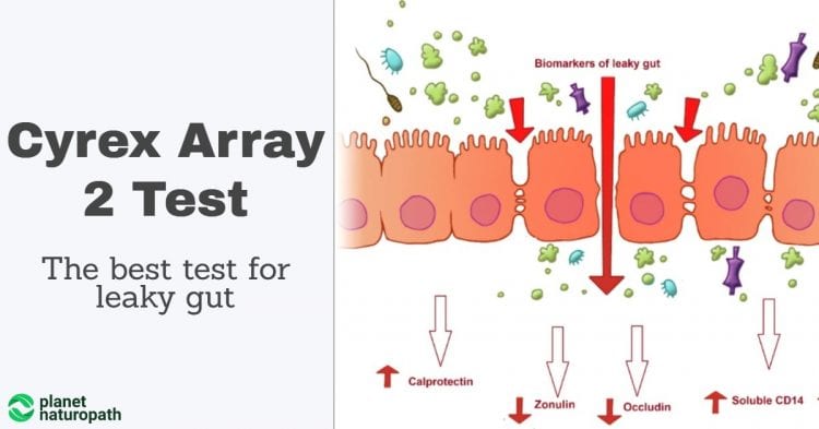 Cyrex Array 2 Test: The Best Test For Leaky Gut!