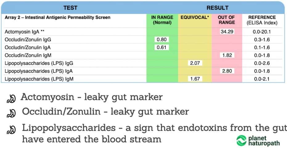 Cyrex Array 2 Test: The Best Test For Leaky Gut!