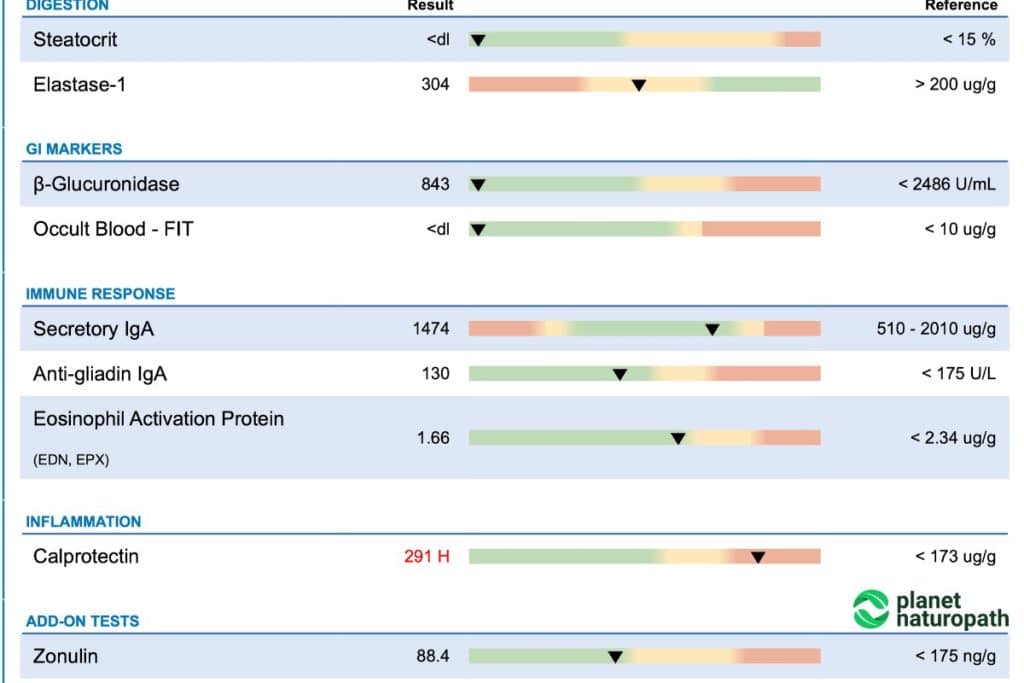Calprotectin Fecal Test: Everything You Need To Know