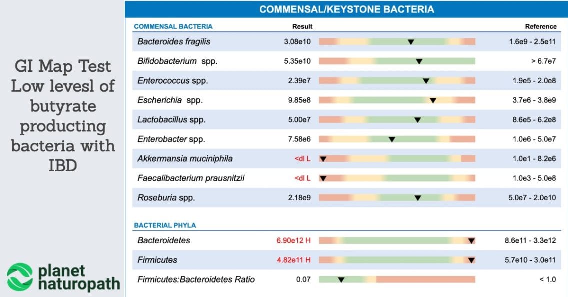 What Is Inflammatory Bowel Disease (IBD)?