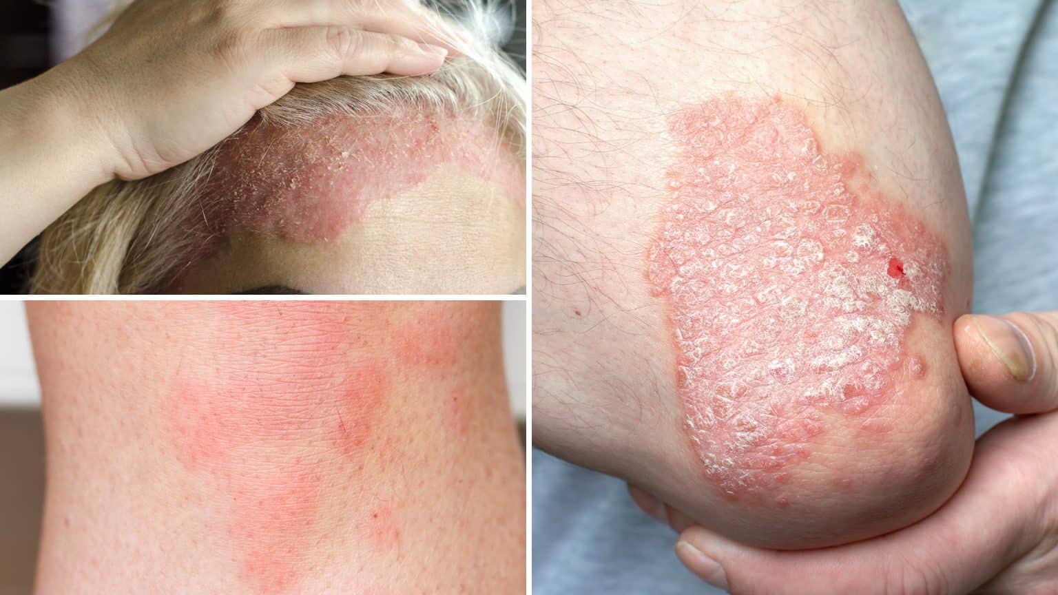 10 Leaky Gut Symptoms You Should Never Ignore